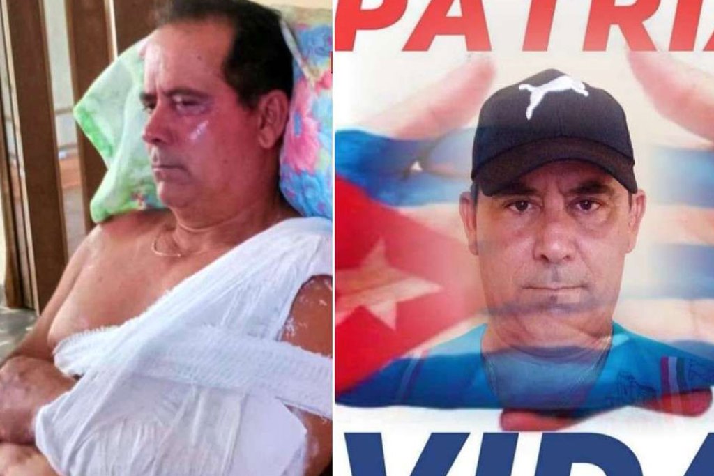 Agreden al periodista independiente cubano Alberto Corzo después de que ...